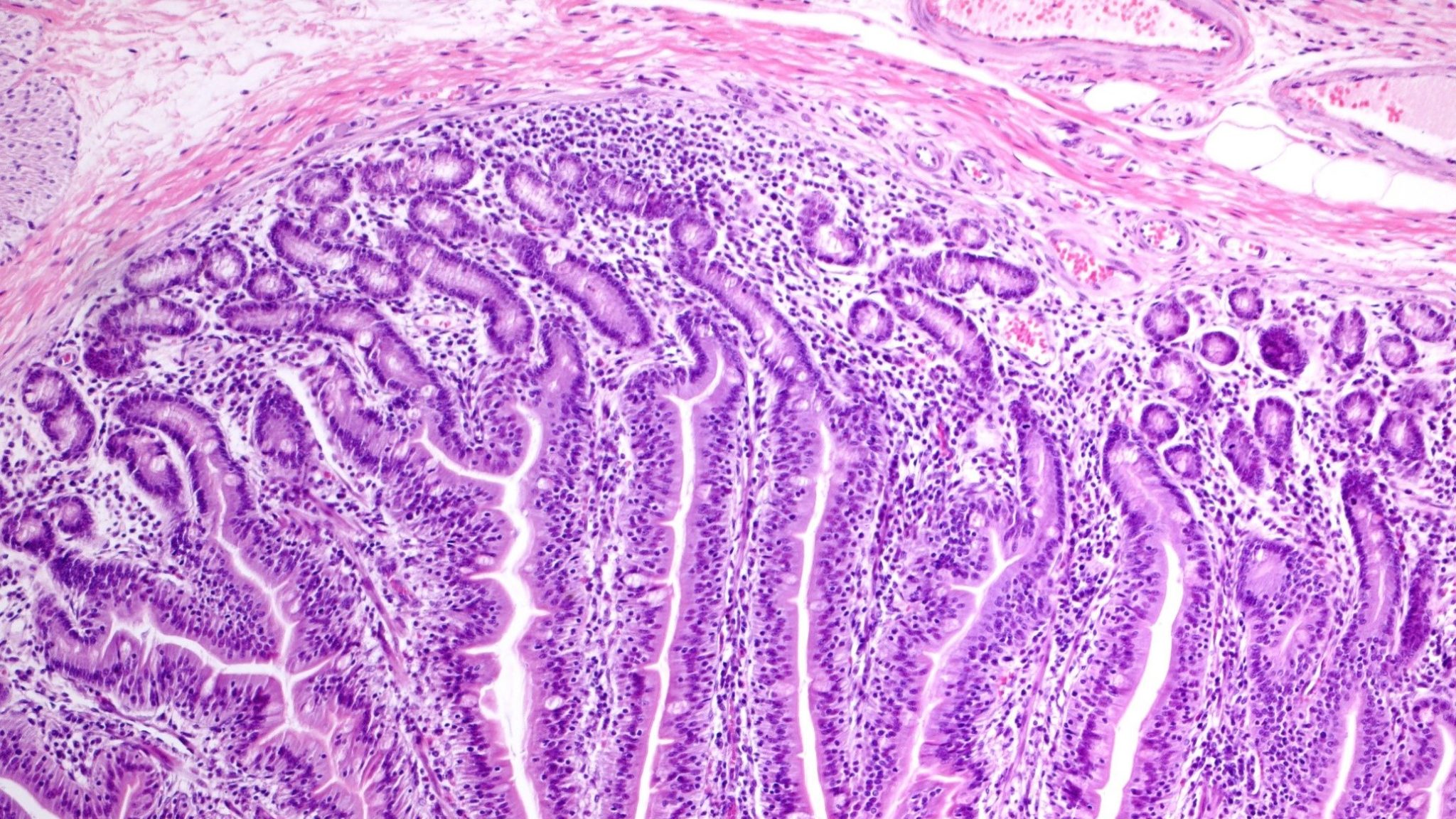 Postbiotics - What Are They and How Do They Work?