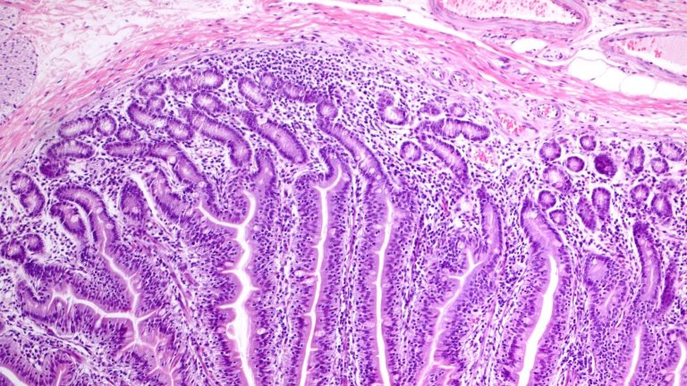 Postbiotics - What Are They and How Do They Work?